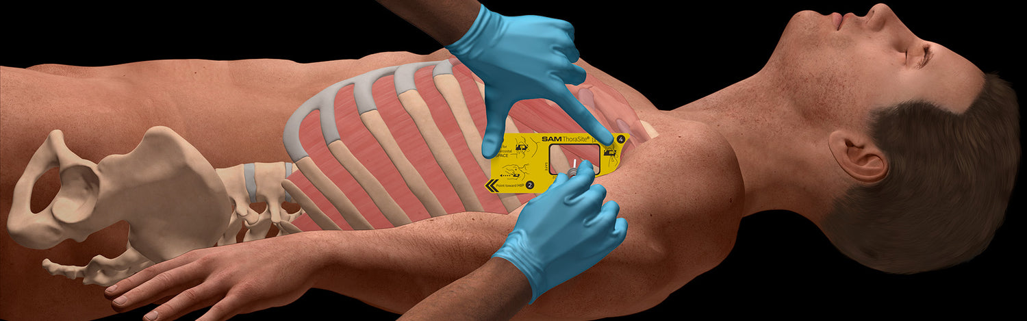 SAM Medical Products | Shop Medical Supplies Online – SAM Medical Store